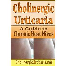 Find the best price on Cholinergic Urticaria: A Guide to Chronic Heat ...