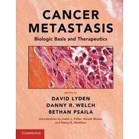 Find the best price on David Lyden: Cancer Metastasis | Compare deals ...